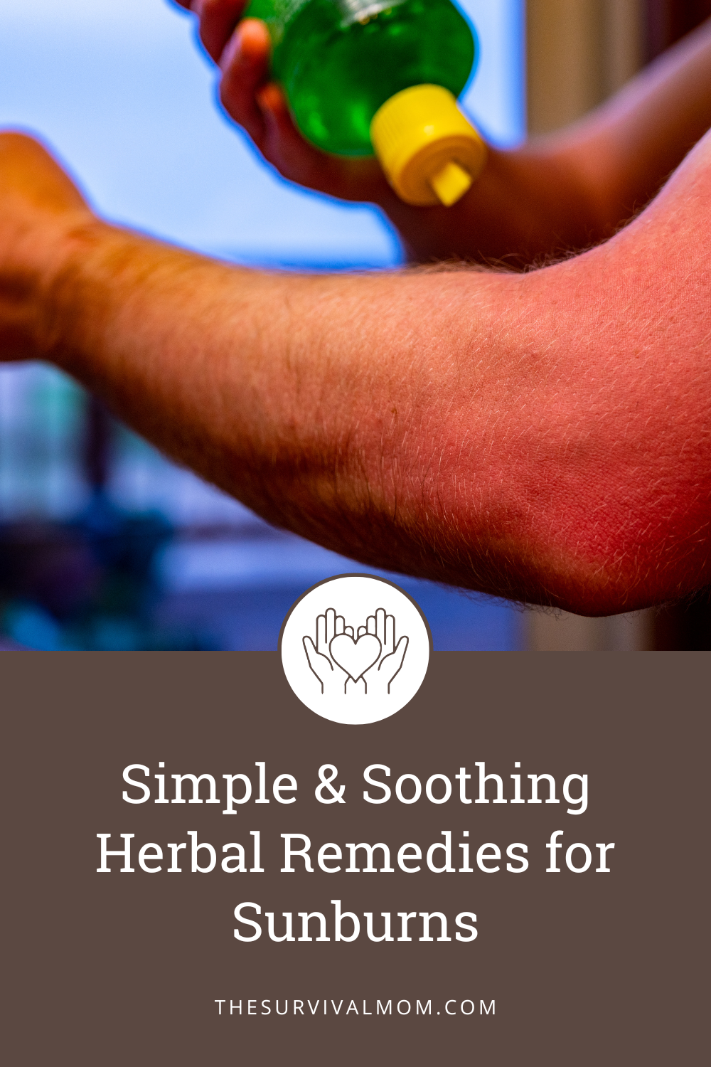 Simple & Soothing Herbal Remedies for Sunburns - The Survival Mom