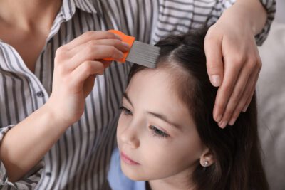 Don't Panic! An Easy Guide to Treating Lice - Survival Mom